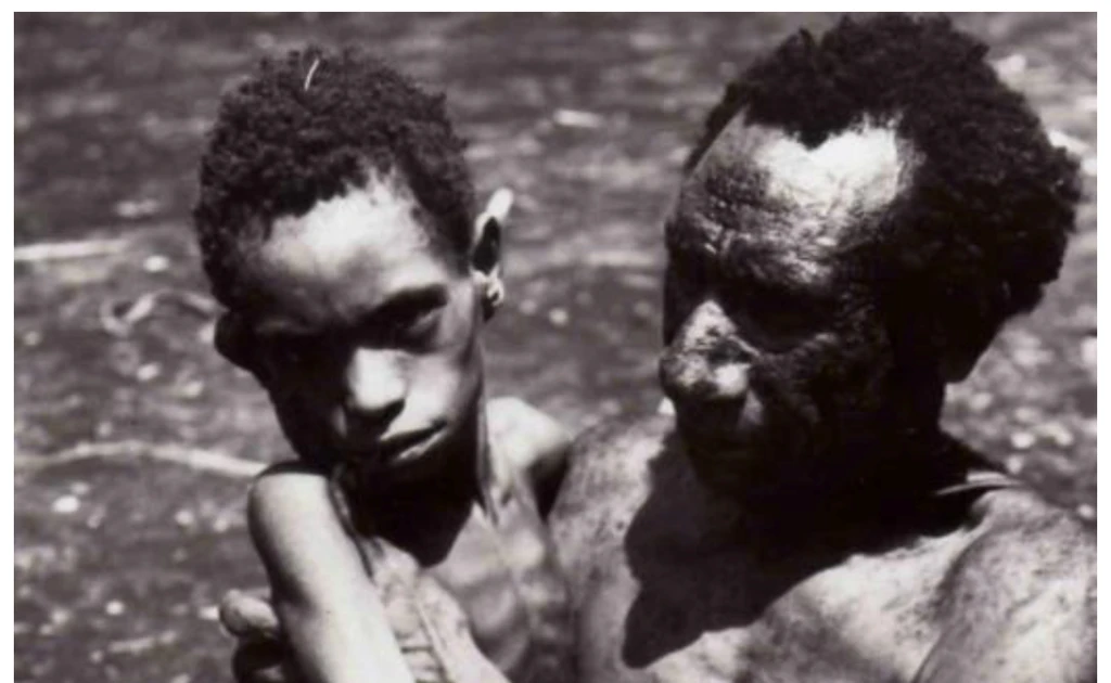 Bộ tộc ăn não người và 'chìa khóa' chống bệnh mất trí nhớ | Báo Pháp ...