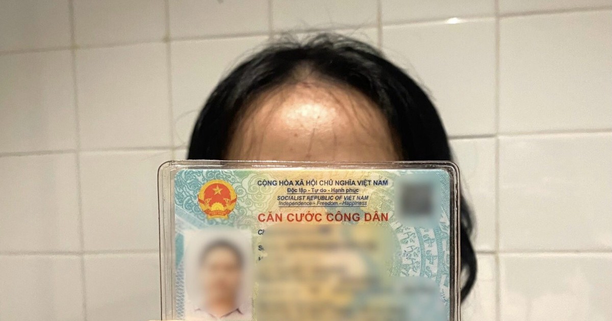 Sau phẫu thuật thẩm mỹ, có cần đổi lại CCCD không? | Báo Pháp Luật TP. Hồ Chí Minh