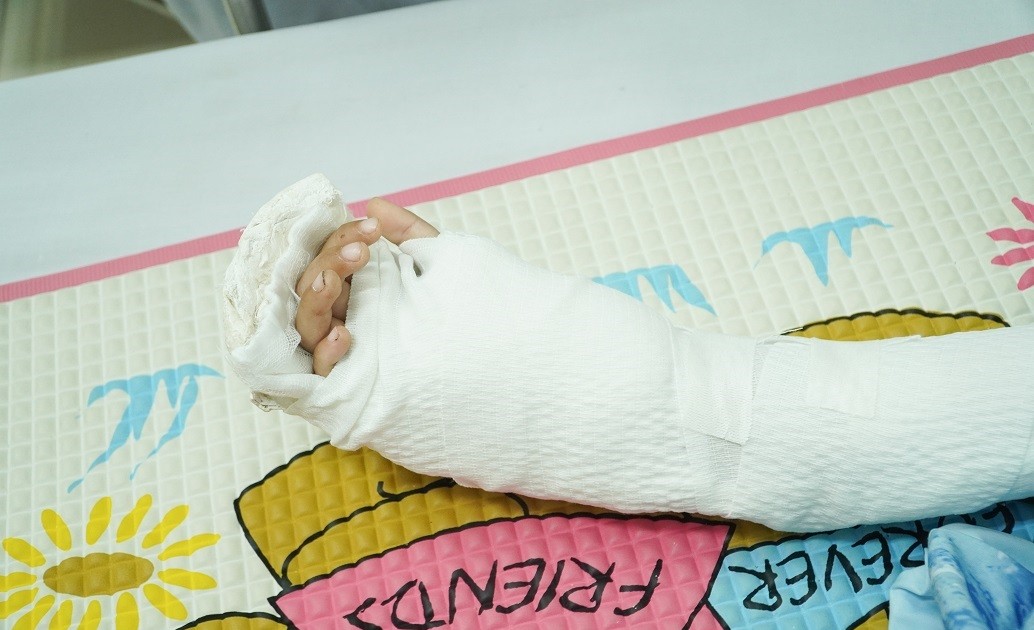 Báo động đỏ nối bàn tay đứt lìa cho bé trai 5 tuổi bị tai nạn giao ...