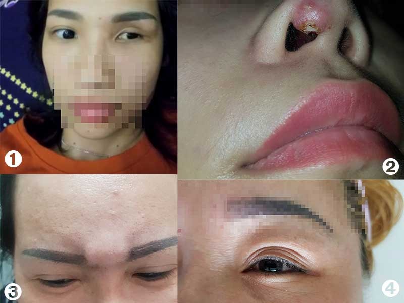 Làm đẹp ‘chui’: Muôn vàn tai biến khóc cười | Báo Pháp Luật TP. Hồ Chí Minh